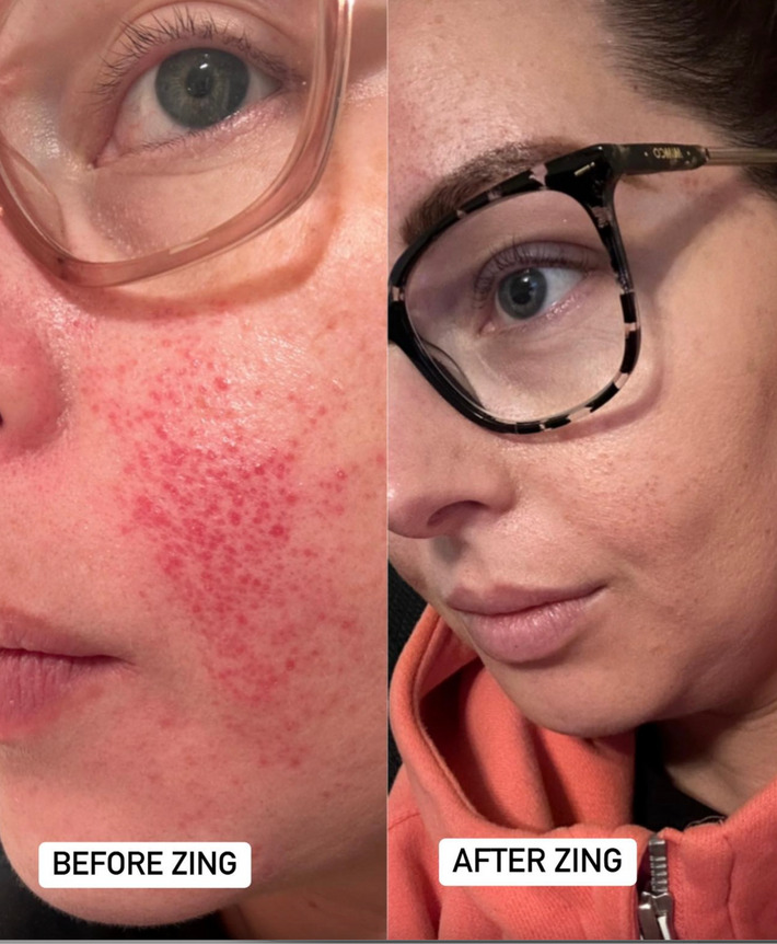 Zing Wellbeing Health Program